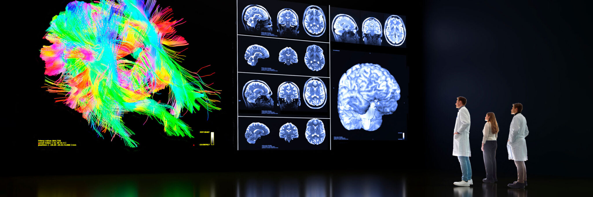 UKB NewsRoom | Mit dem KI-Projekt epi-center.ai zum Epi-Zentrum